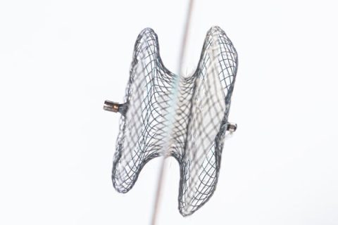 PFO Closure - Auburn Cardiology Centre